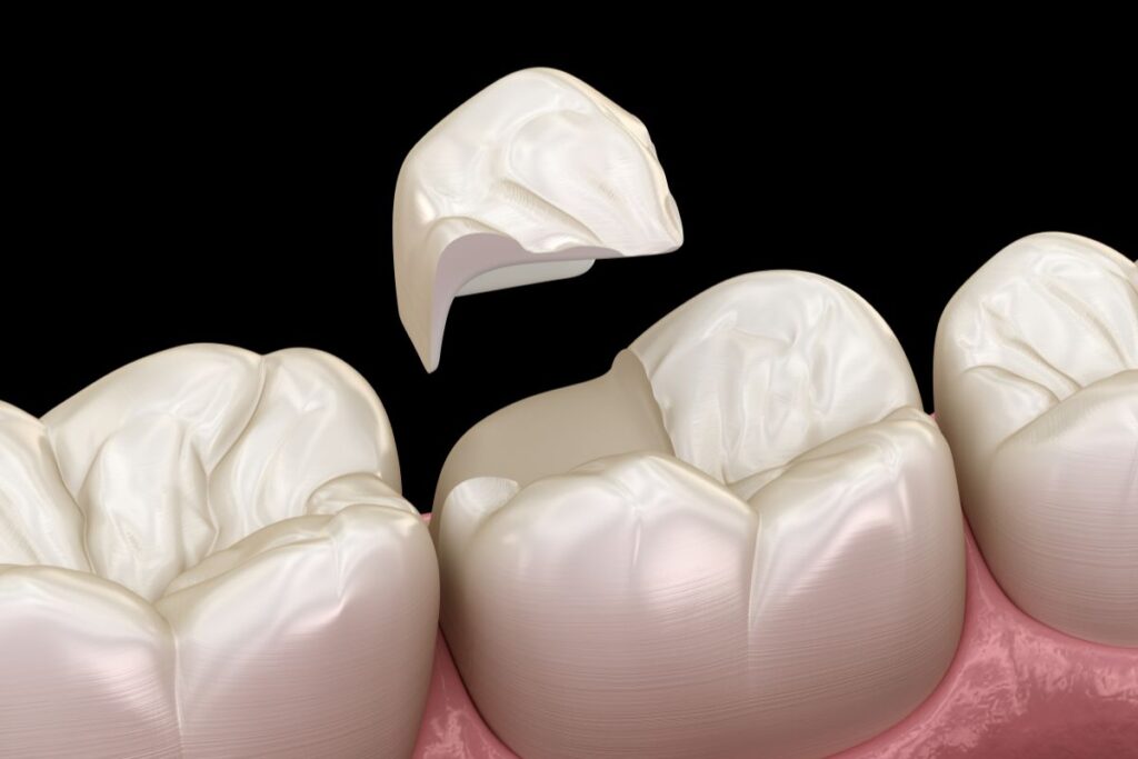 Does Enamel Grow Back? Everything You Need to Know